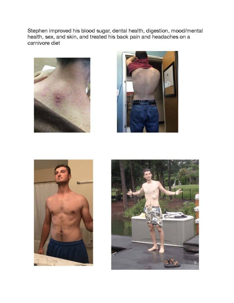 Transformations - Carnivore Diet