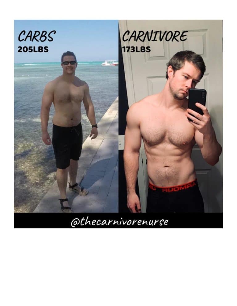 Transformations - Carnivore Diet